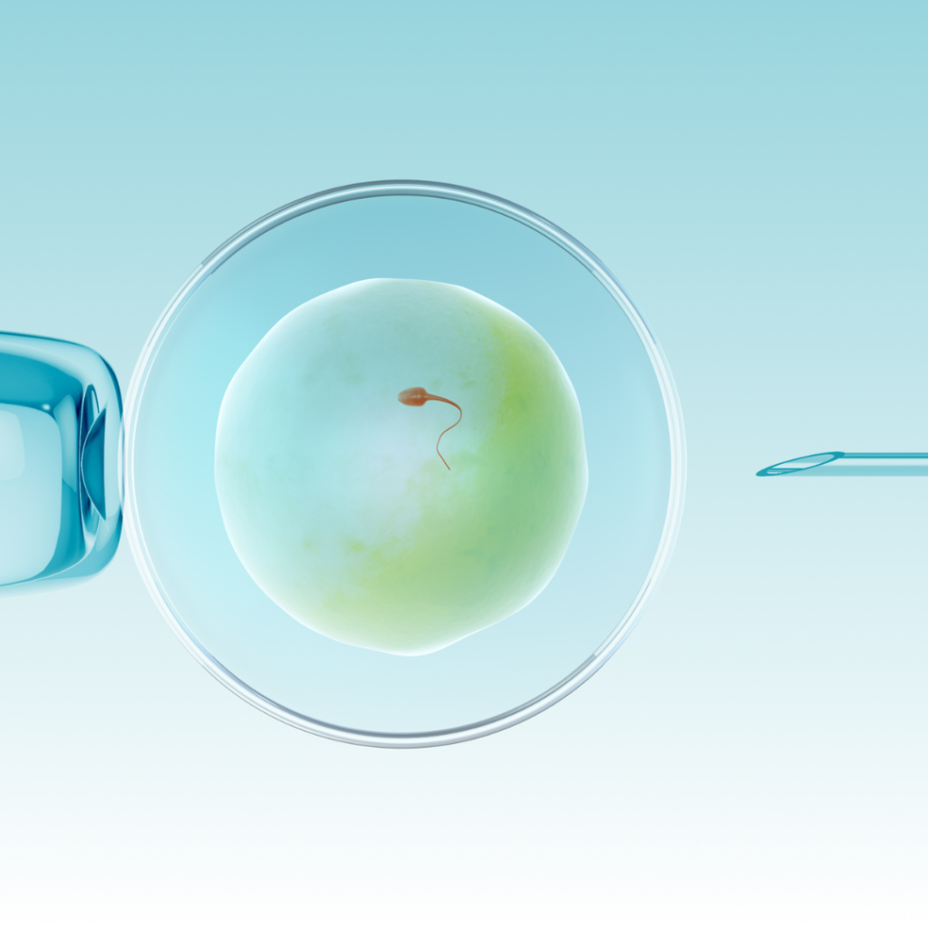 Intracytoplasmic Sperm Injection - EMC Cradle Hospital