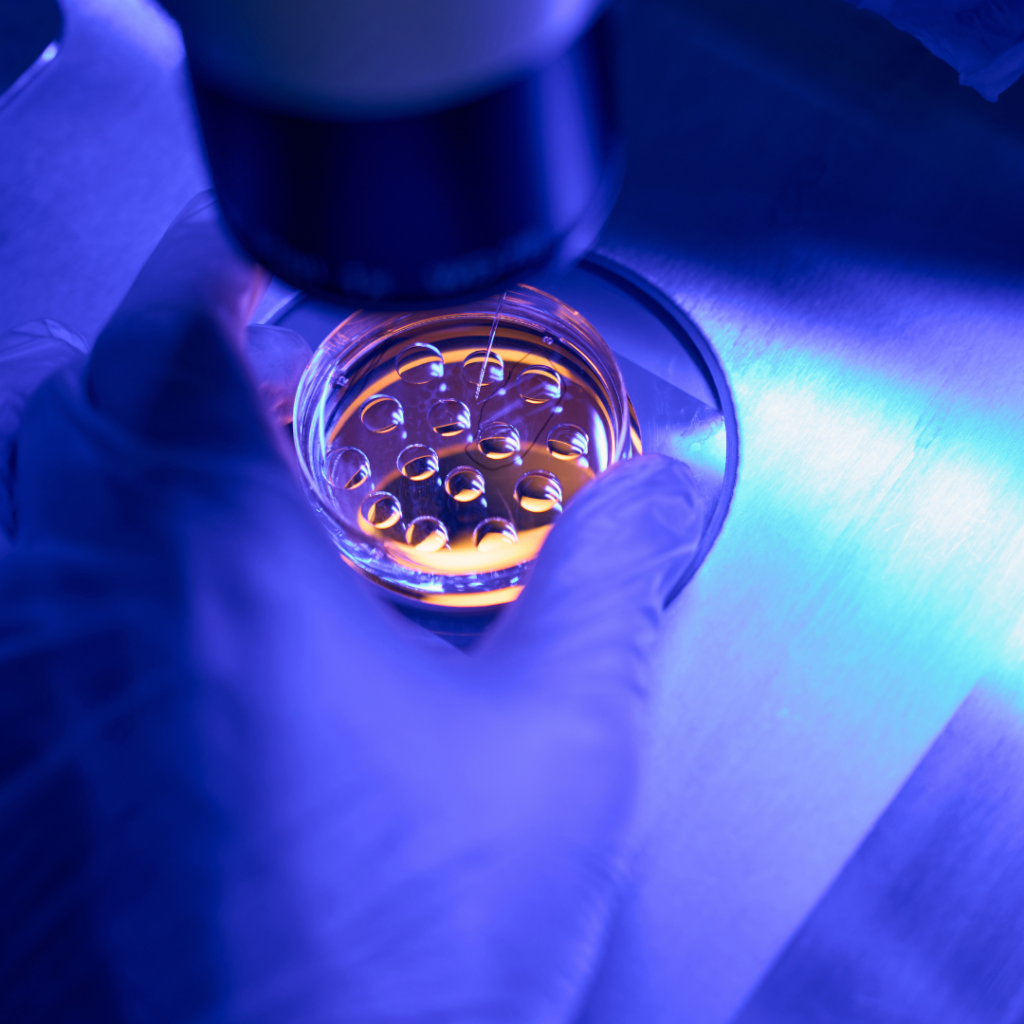 Physiological Intracytoplasmic Sperm Injection - EMC Cradle Hospital